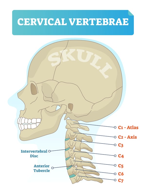 Cervical Herniated Discs: Causes & Symptoms